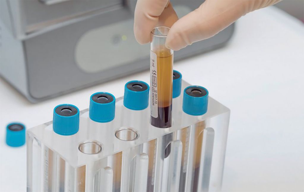 PRGF – Clínica Dental Salcodent 🦷 | Getafe